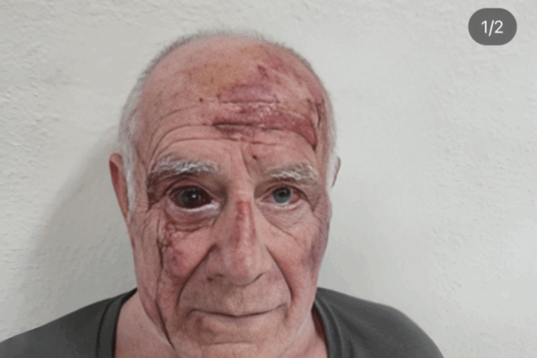 Una Banda De Magrebíes Asalta Las Calles De Torre Pacheco